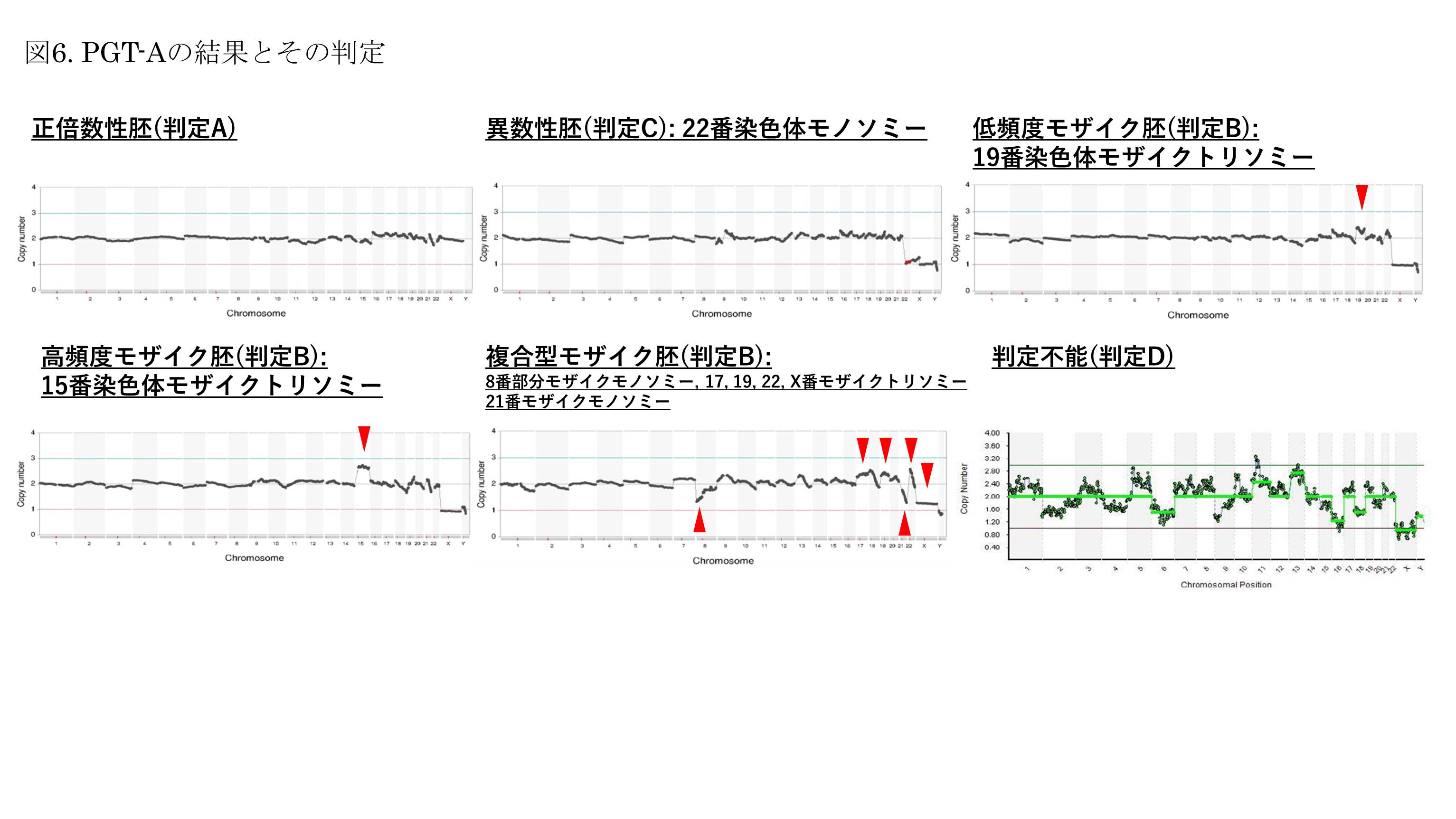 着床前診断(PGT-A、PGT-SR、PGT-M)について - セントマザー産婦人科医院
